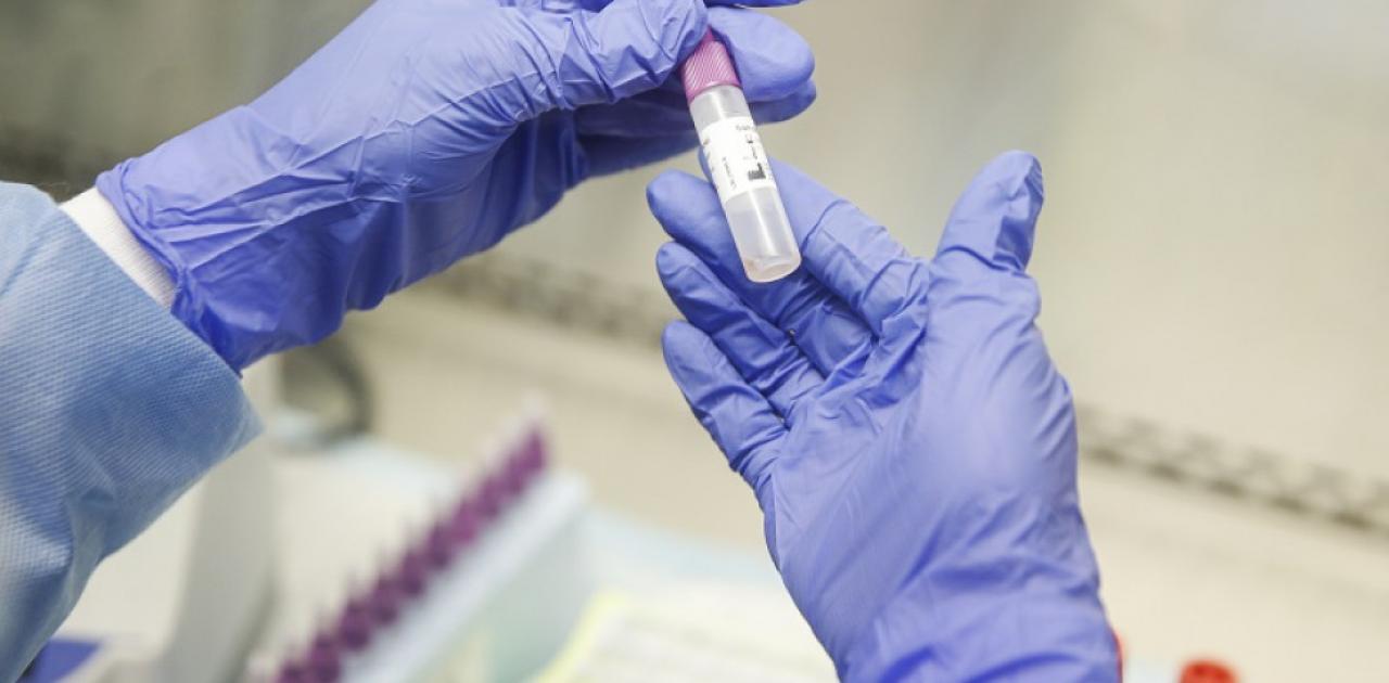 Δεν προστατεύει από τoν Covid-19 το εμβόλιο για τη φυματίωση ...