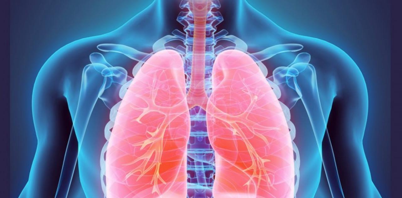 Πνευμονικό οίδημα: Μια σοβαρή και επικίνδυνη πάθηση των πνευμόνων ...