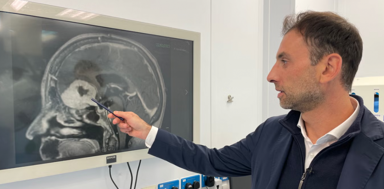 Παγκόσμια καινοτομία: Έλληνας νευροχειρουργός αφαιρεί μεγάλους όγκους ...