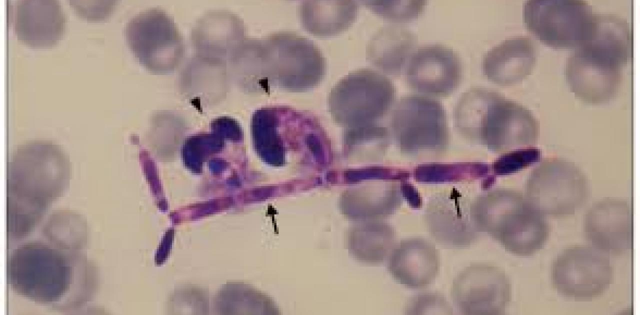 Προειδοποίηση για την Candida parapsilosis, τον εξαιρετικά ανθεκτικό ...