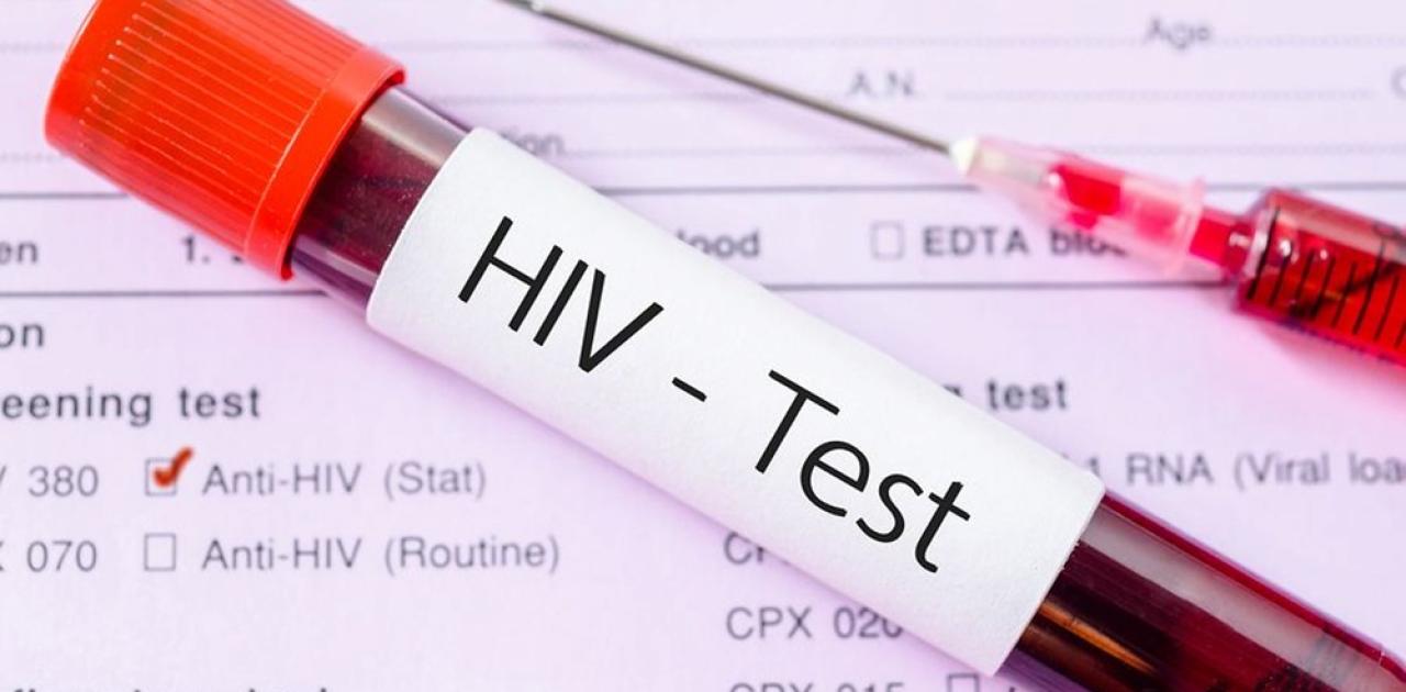 Νέο φάρμακο «ασπίδα» από το AIDS θα κυκλοφορήσει στην Ευρώπη ...