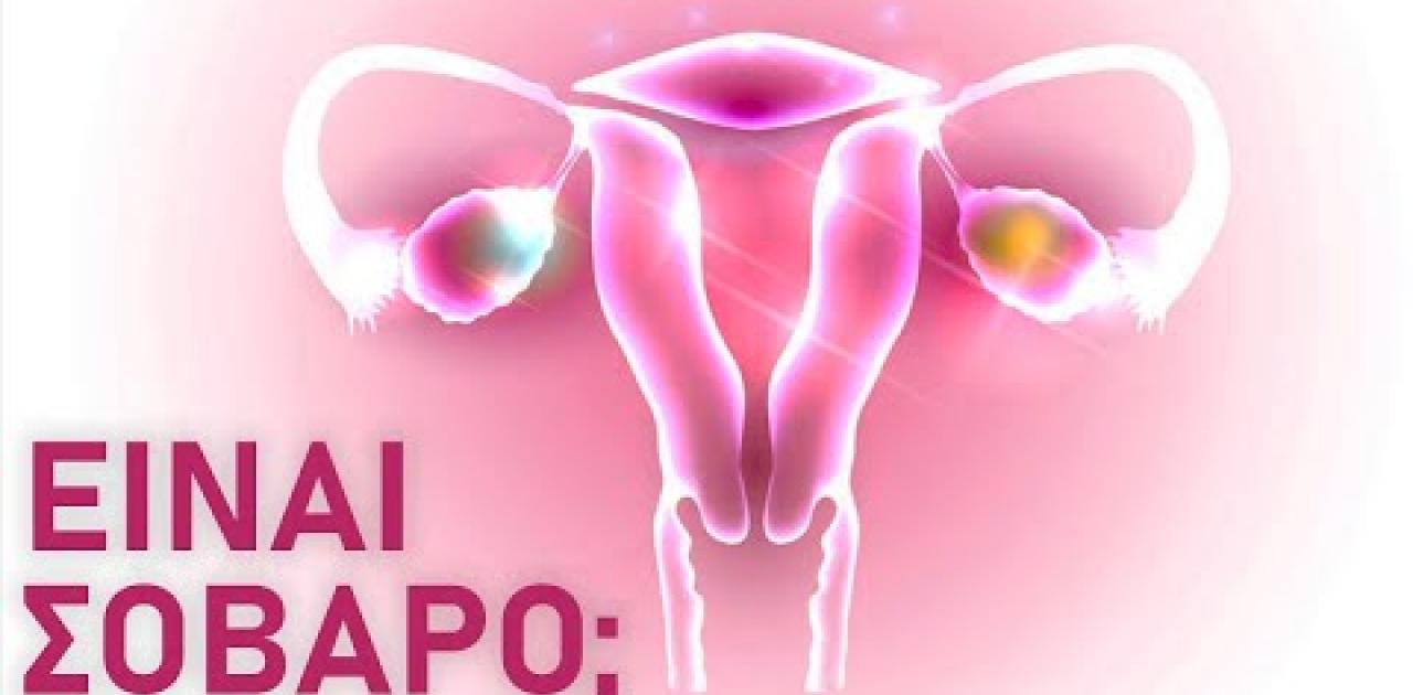 Δείτε τους λόγους εμφάνισης πολύποδα στον τράχηλο της μήτρας ...